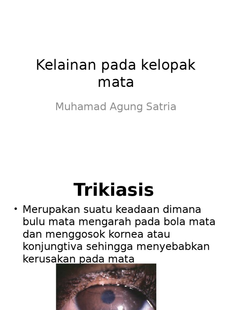 Kelainan Kelopak Mata: Trikiasis, Entropion, Ektropion | PDF | Sains ...