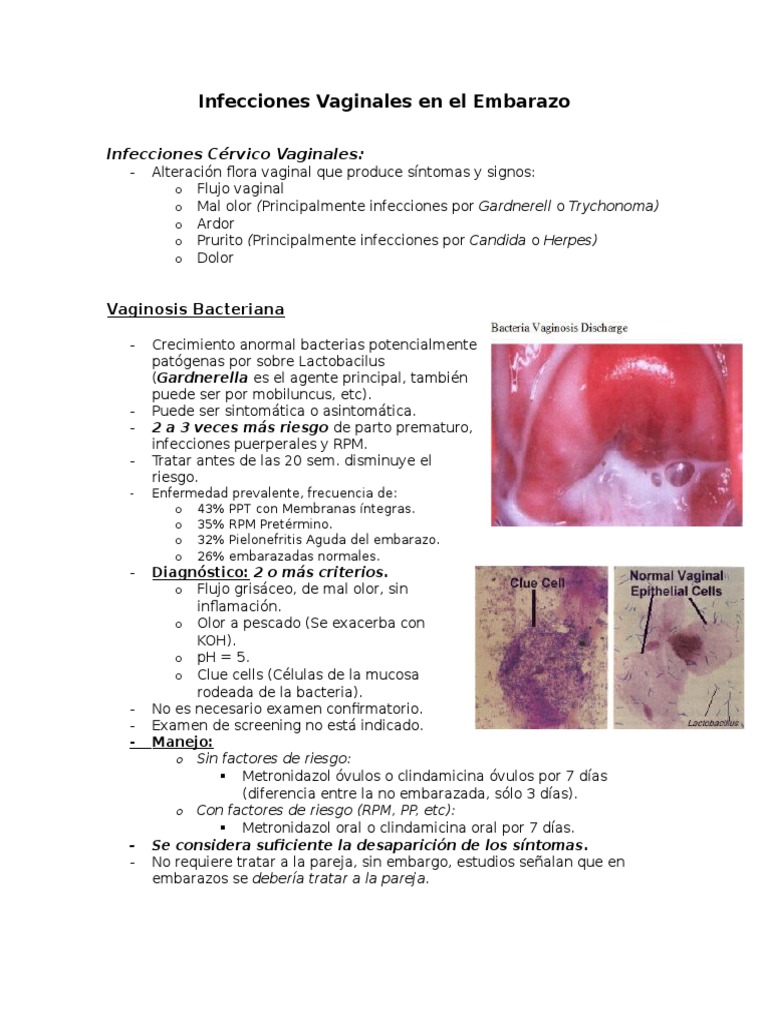 Resumen Infecciones Vaginales e ITU (Con Imagenes) - Copia | Rtt ...