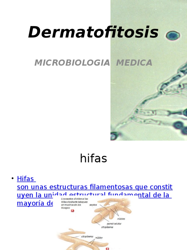 Dermatofitosis: Tipos y Tratamiento | PDF | Microbiología | Dermatología