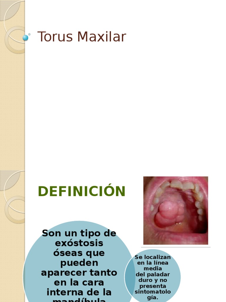 Torus Mandibular | PDF | Dentadura postiza | Diente humano