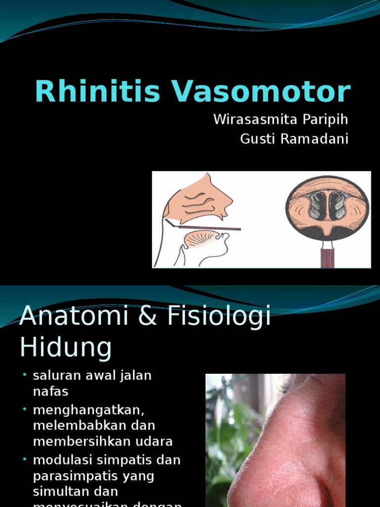 Rhinitis Vasomotor | PDF