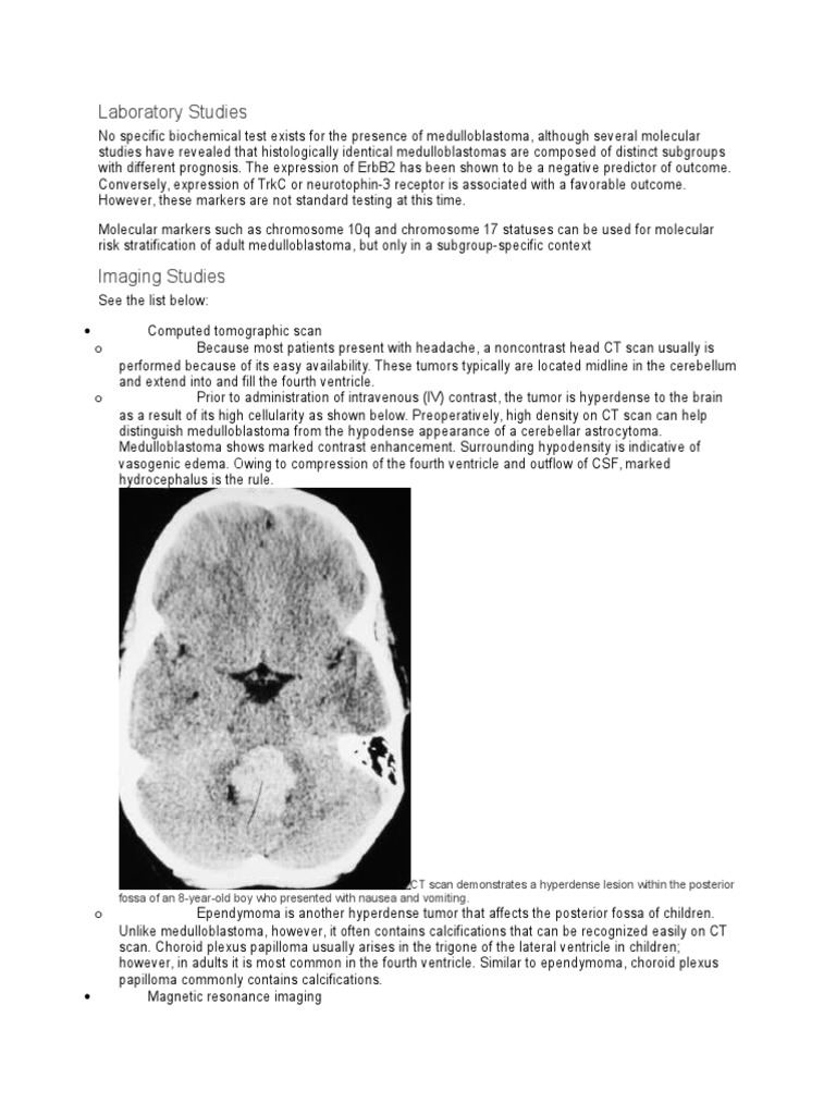 Medulloblastoma | PDF | Magnetic Resonance Imaging | Cerebrospinal Fluid