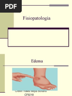 Tipos de Edemas | PDF | Edema | Medicina