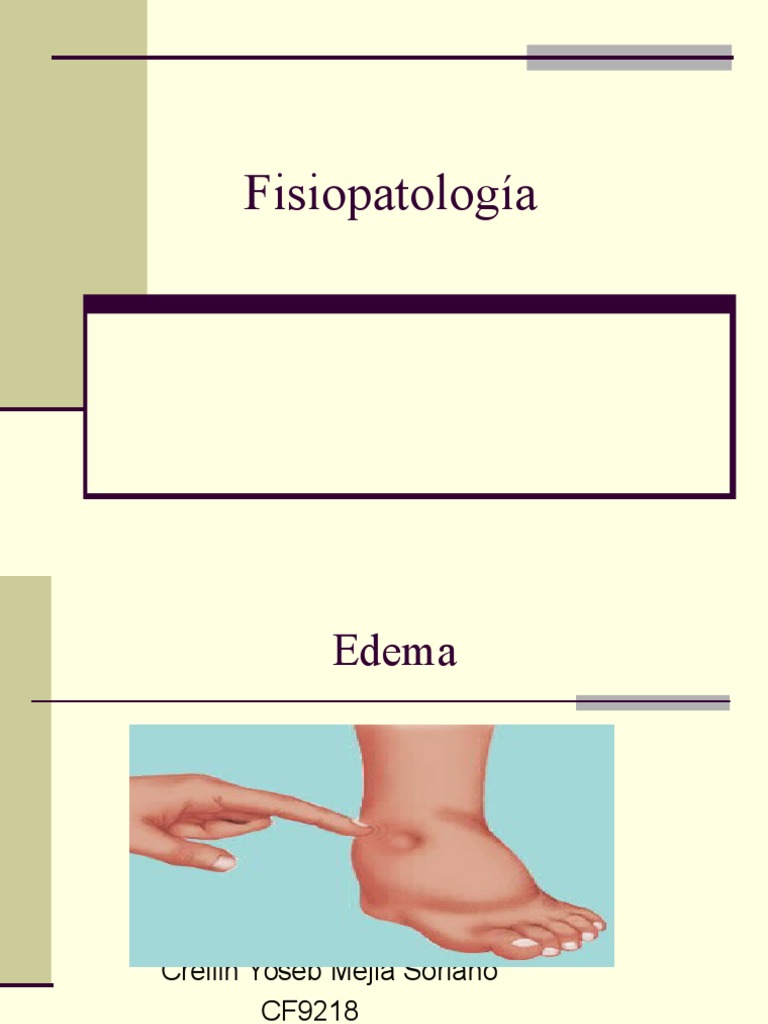 Tipos y causas del edema clínico | PDF | Edema | Medicina CLINICA
