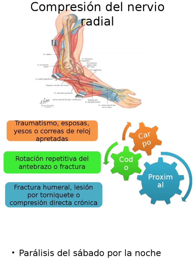 Compresión Del Nervio Radial