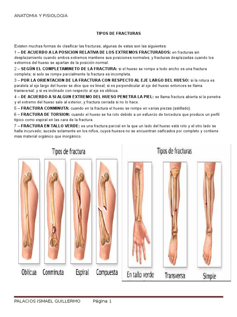 Tipos y etapas de las fracturas | PDF | Hueso | Cartílago