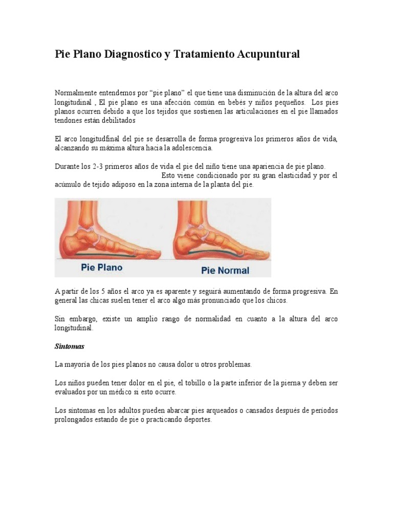 Pie Plano Diagnostico y Tratamiento Acupuntural | PDF | Pie | Medicina ...