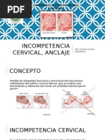 Protocolo de Cerclaje Cervical en Obstetricia | PDF | Parto | El embarazo