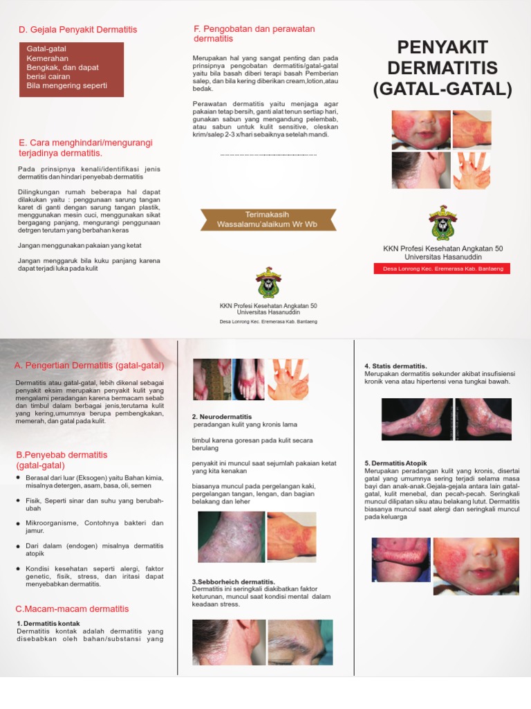 Leaflet Dermatitis Pdf