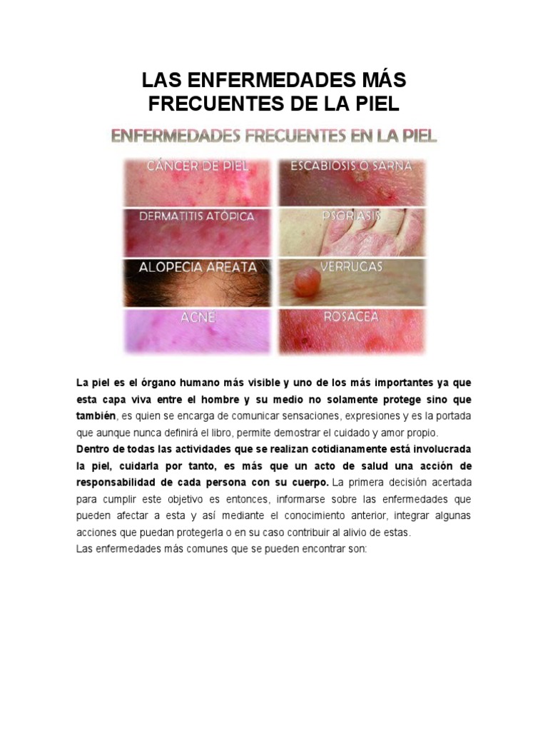 Las Enfermedades Más Frecuentes de La Piel | Piel | Cáncer