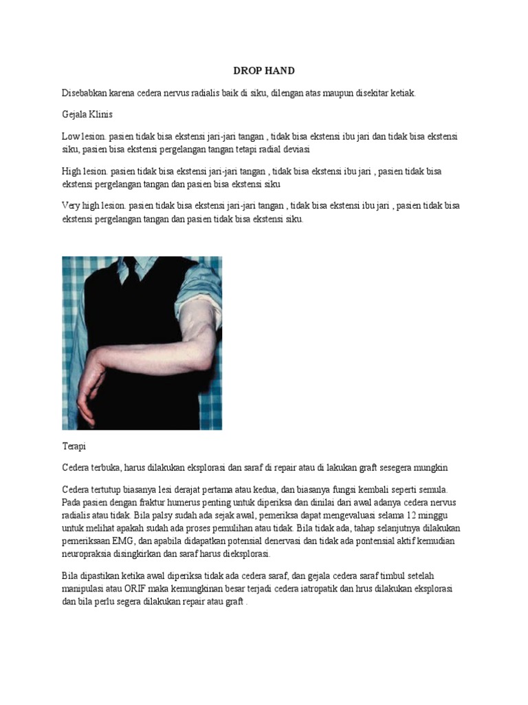 Drop Hand Syndrome: Clinical Presentation and Management of Radial ...