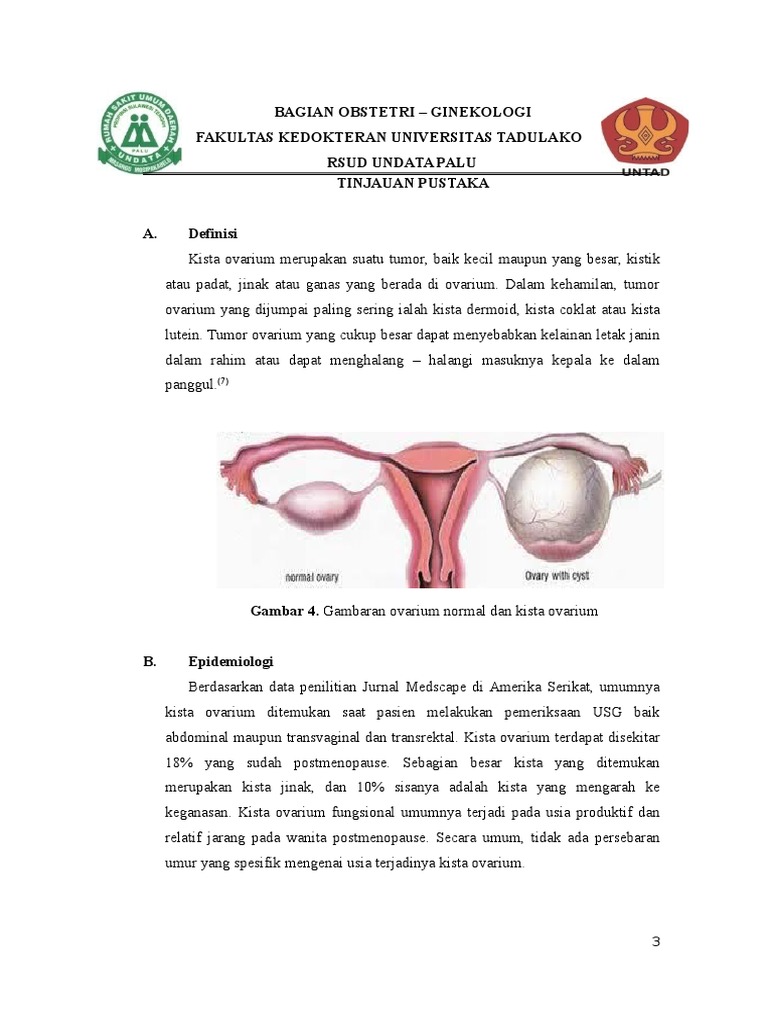 Kista ovarium
