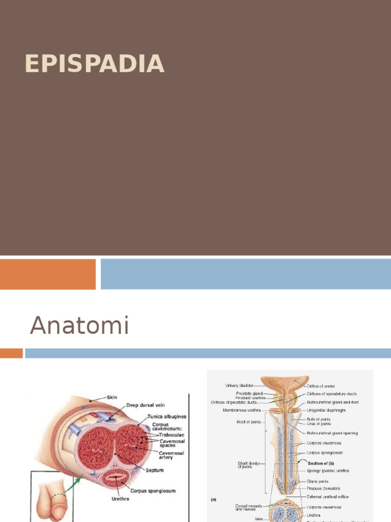 Epispadia | PDF | Seni & Disiplin Bahasa | Kesehatan Holistik