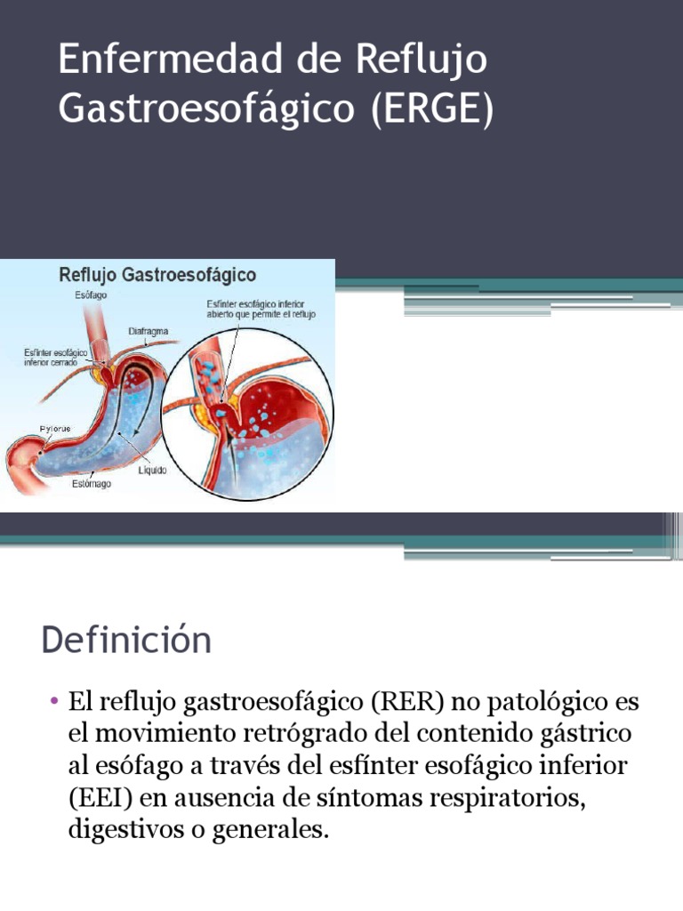 Erge | PDF | La enfermedad por reflujo gastroesofágico | Rtt