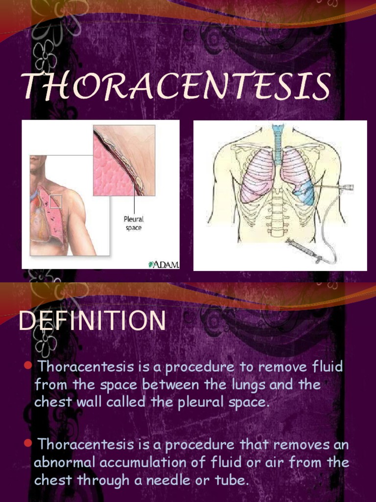 Thoracentesis | PDF | Respiratory System | Clinical Medicine