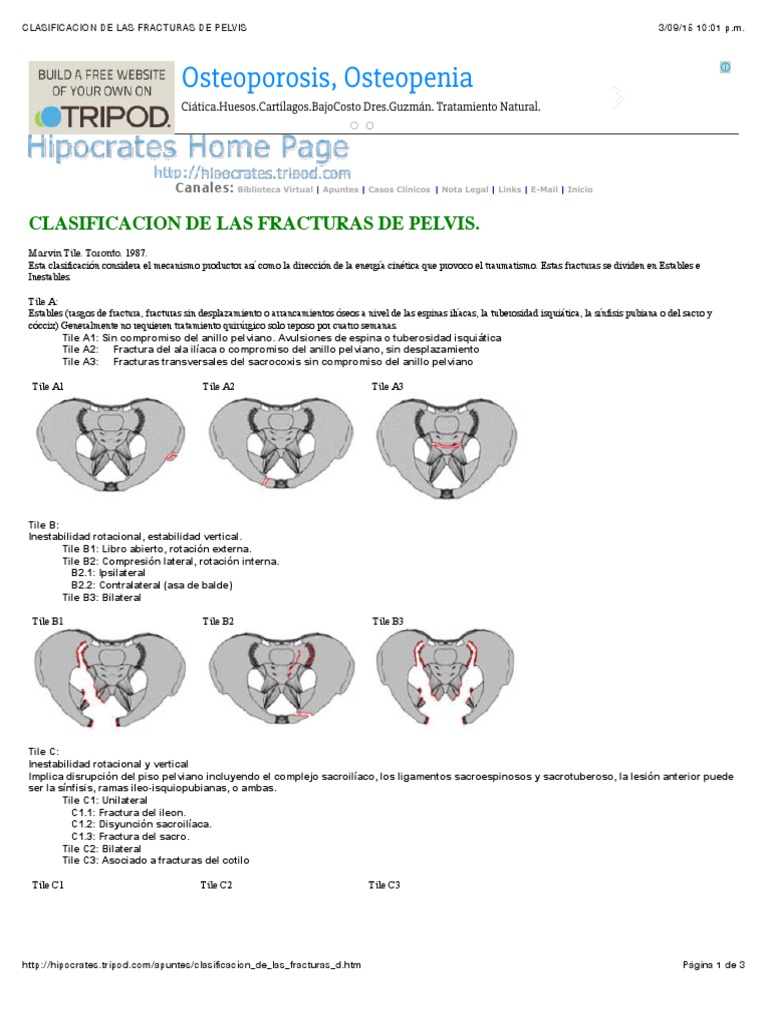 A Comparison of Tile and Judet-Letournel Classification Systems for ...
