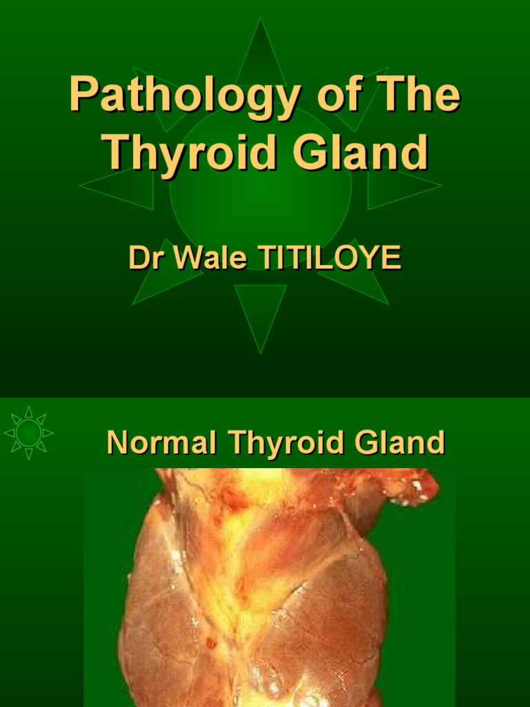 Pathology Of Thyroid Download Free Pdf Thyroid Hyperthyroidism