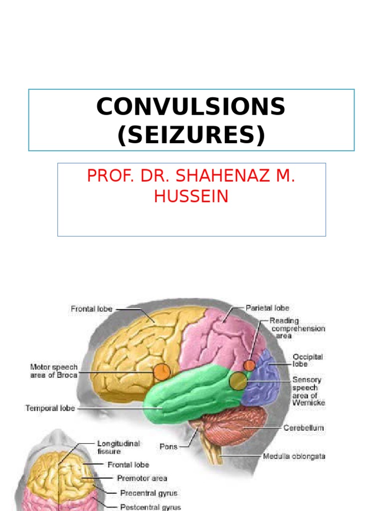 Convulsions (Seizures) | Epilepsy | Neurological Disorders | Free 30 ...