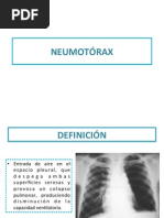 Fases Fisiopatologicas de La Neumonia | PDF | Leucocito | Sangre