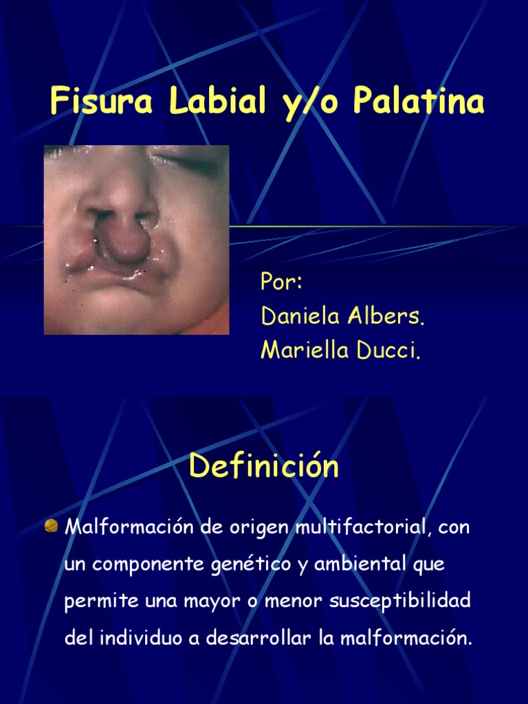 Fisura Labial y Palatina | PDF | Ciencia y matemáticas