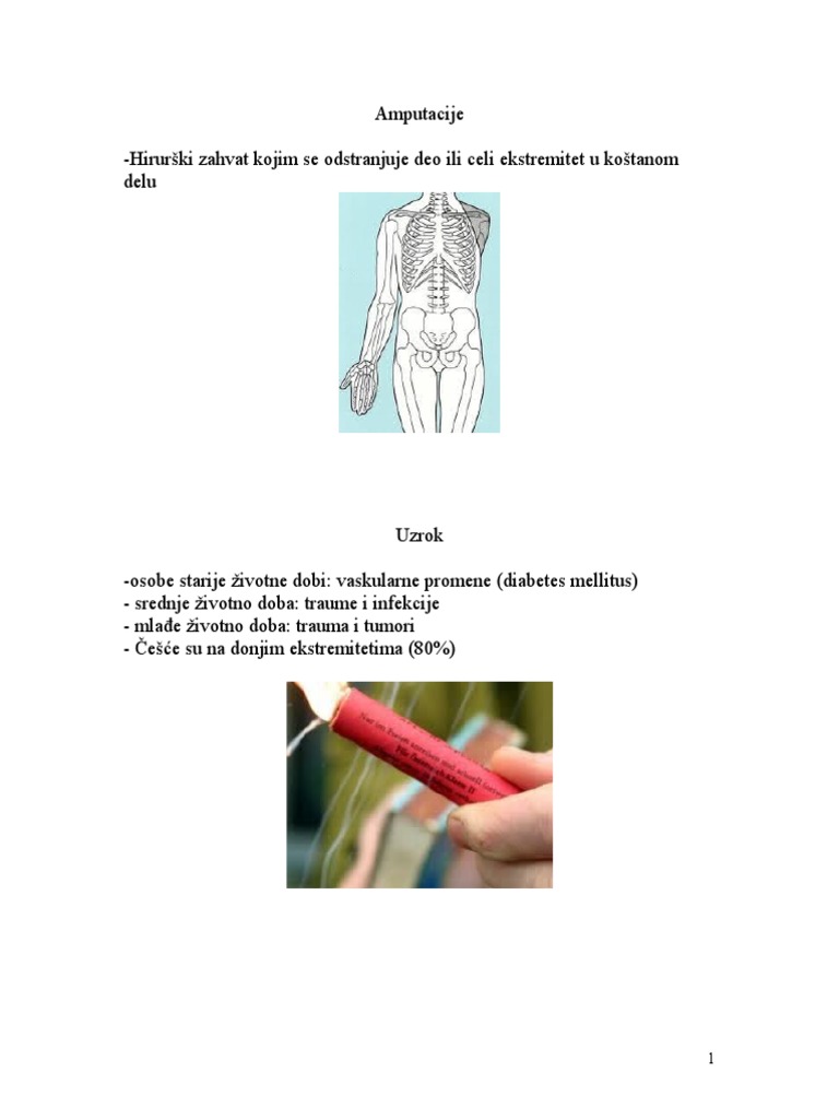 Amputacija seminarski rad