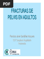 Fracturas de Cotilo | PDF | Pelvis | Sistema esquelético