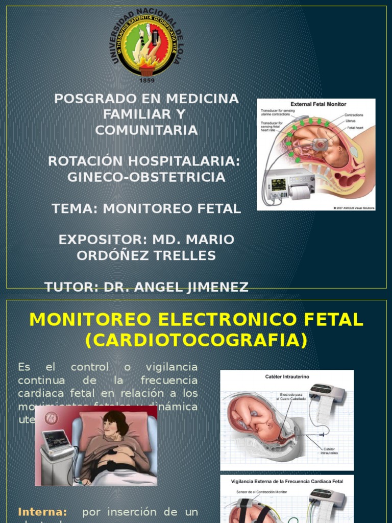 Monitoreo Fetal y Cardiotoografía | PDF | Parto | El embarazo