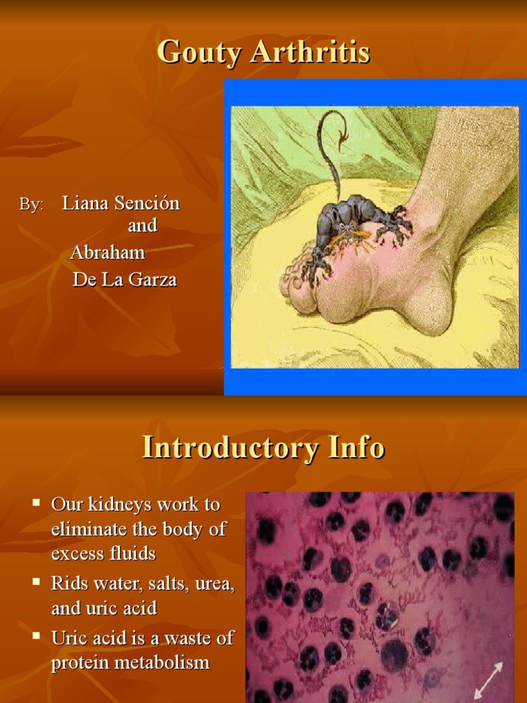 Gout Powerpoint | PDF