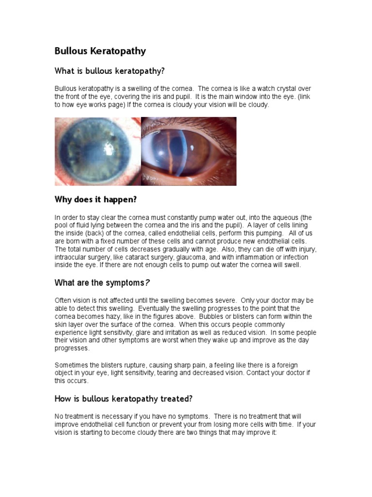 Bullous Keratopathy | Cornea | Human Eye | Free 30-day Trial | Scribd