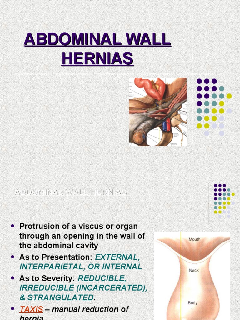 Abdominal Wall Hernias | PDF | Abdomen | Anatomy