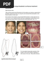 Meaw Technique | PDF | Orthodontics | Clinical Medicine