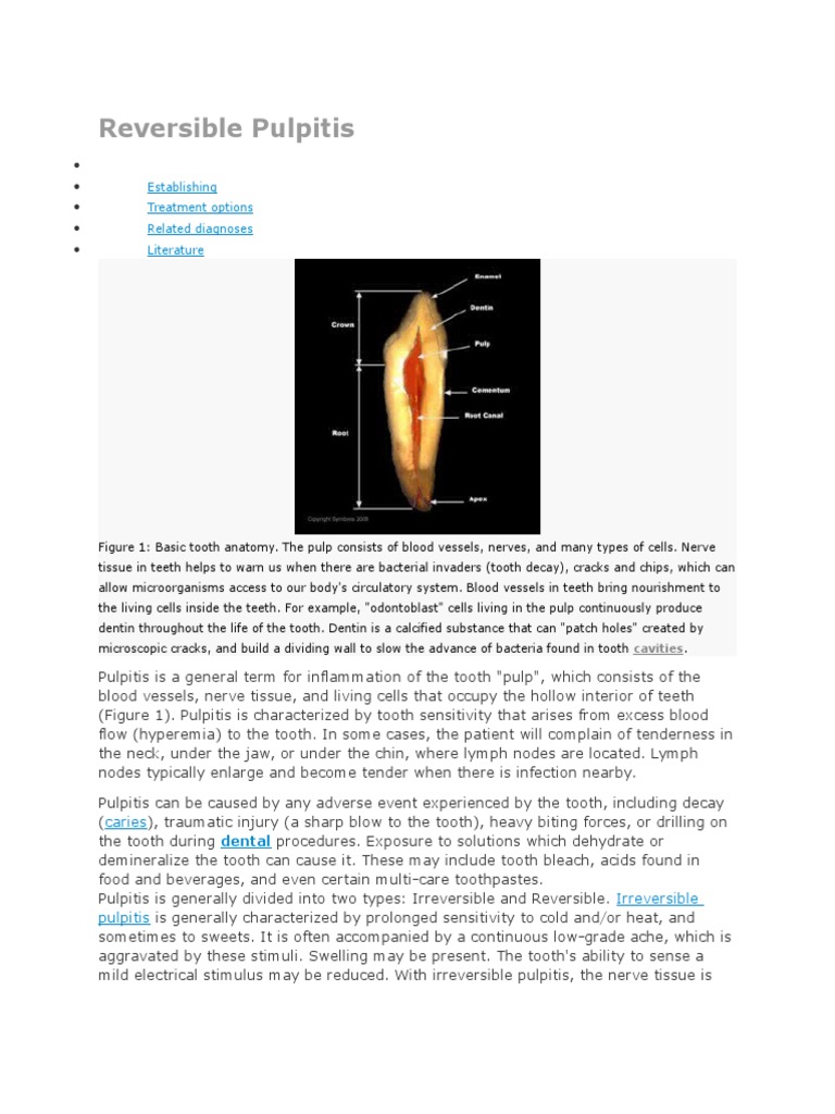 Reversible Pulpitis | PDF | Human Tooth | Medical Specialties