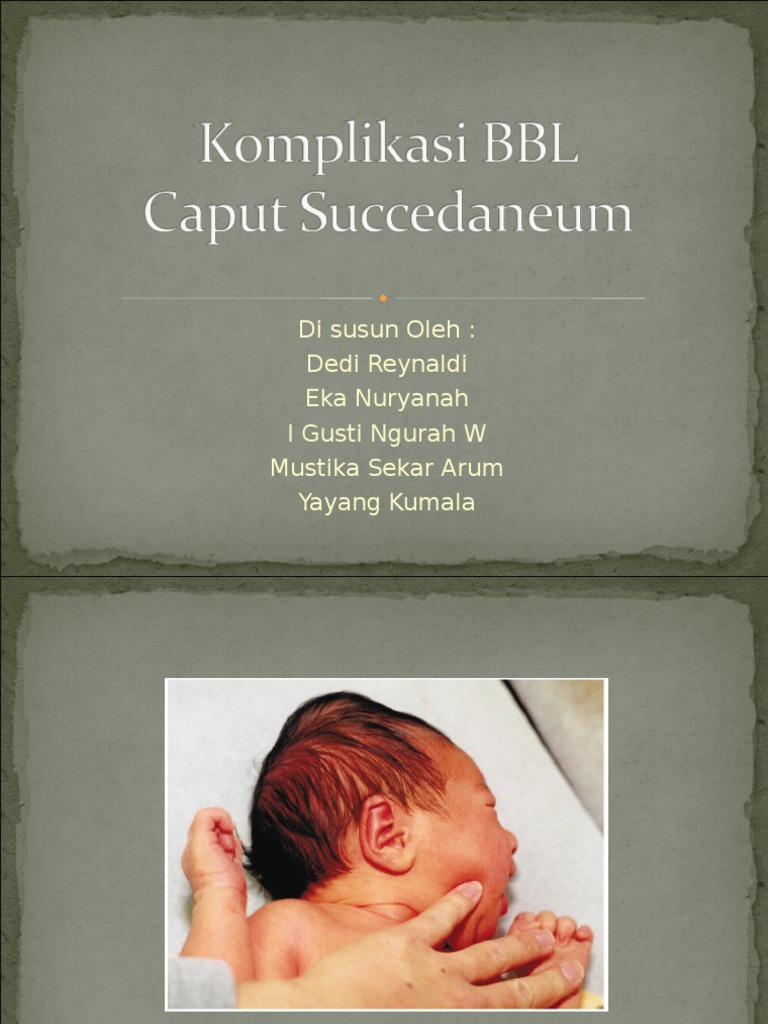 Caput Succedaneum | PDF
