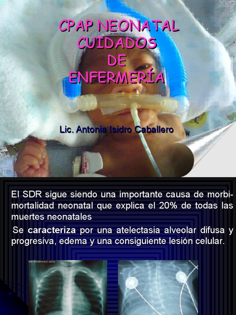 Cuidados de Enfermería en CPAP Neonatal | PDF | Sistema respiratorio ...