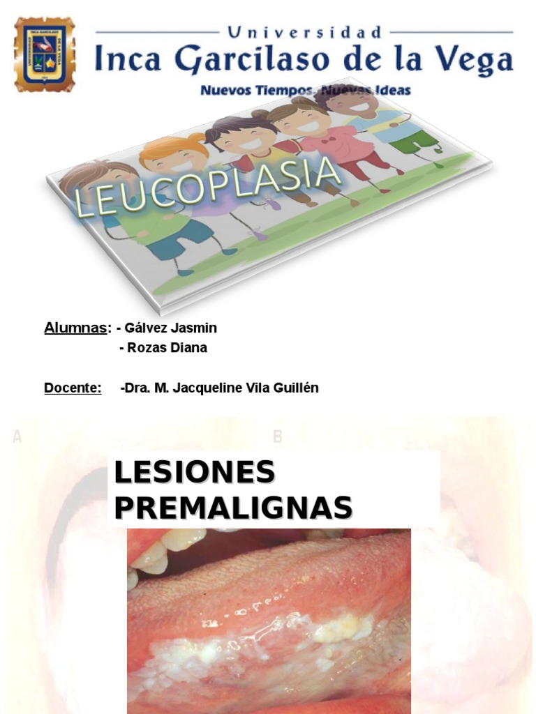 LEUCOPLASIA EXPOSICION | Medicina CLINICA | Especialidades Medicas