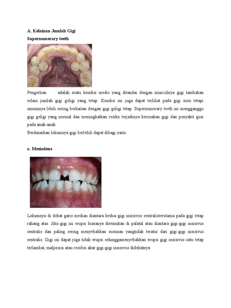 Kelainan Bentuk, Jumlah Dan Warna Gigi | PDF | Kesehatan Holistik