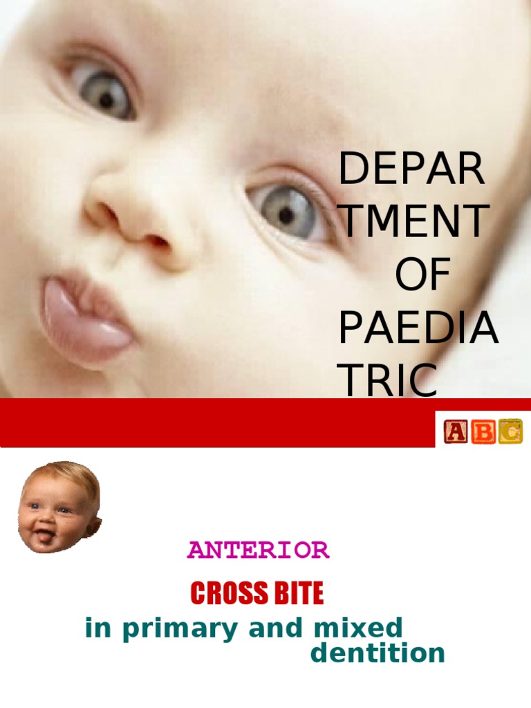 Anterior Cross Bite in Young Patients | PDF | Dental Anatomy | Animal ...