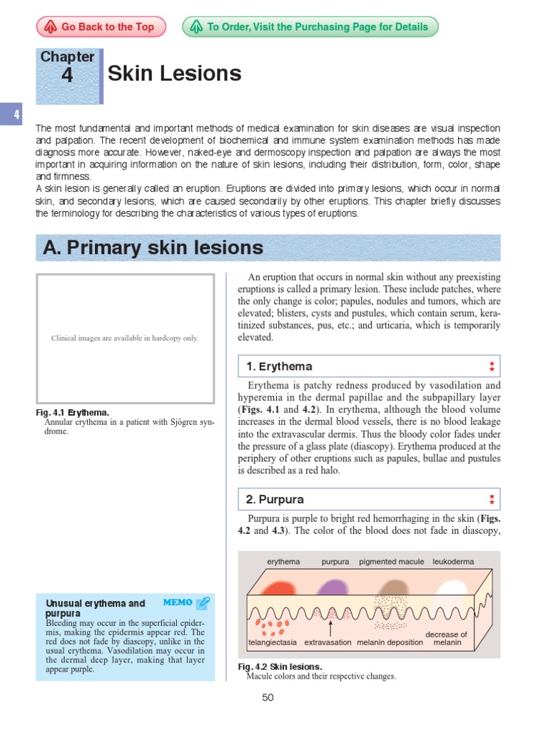 Skin Lesion Types and Descriptions | PDF | Cutaneous Conditions | Scar