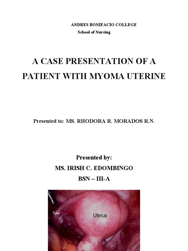 Myoma overview, bibliography and objectives | Uterus | Neoplasms