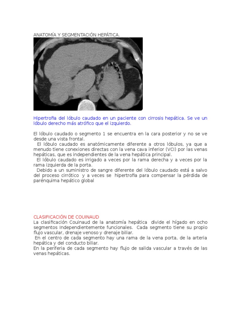 Anatomía y Segmentación Hepática | Hígado | Anatomía