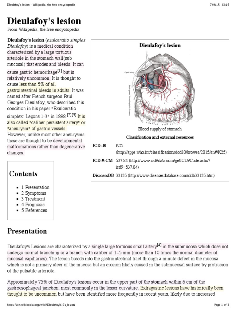 Wikipedia - Dieulafoy's Lesion (CHECKED) | Clinical Medicine ...