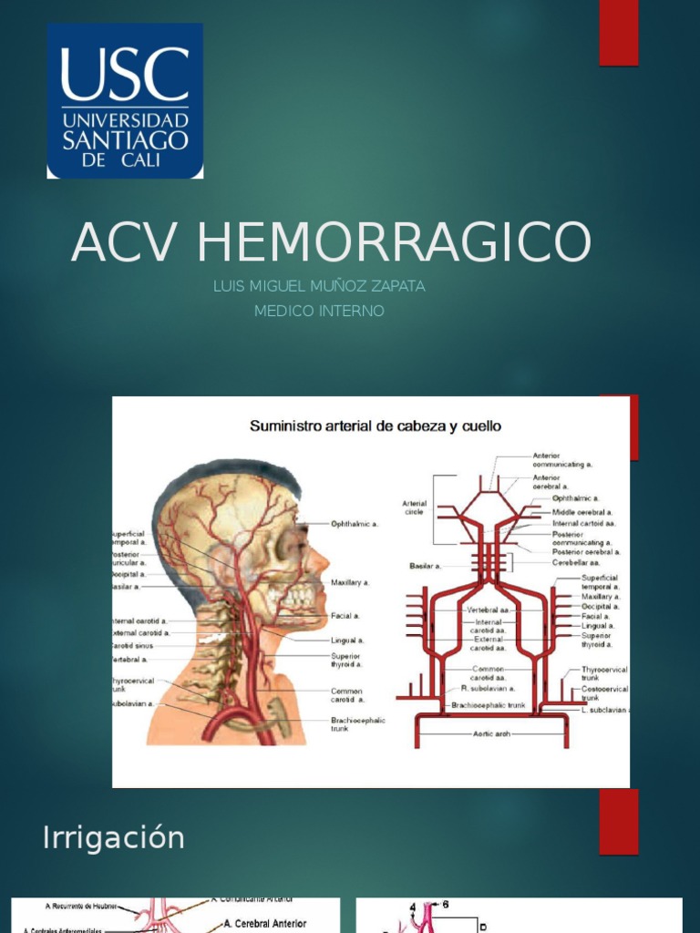 Fisiopatología del ACV Hemorrágico | PDF | Carrera | Isquemia