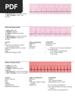 Cardiac Dysrhythmias | PDF | Electrocardiography | Cardiovascular System