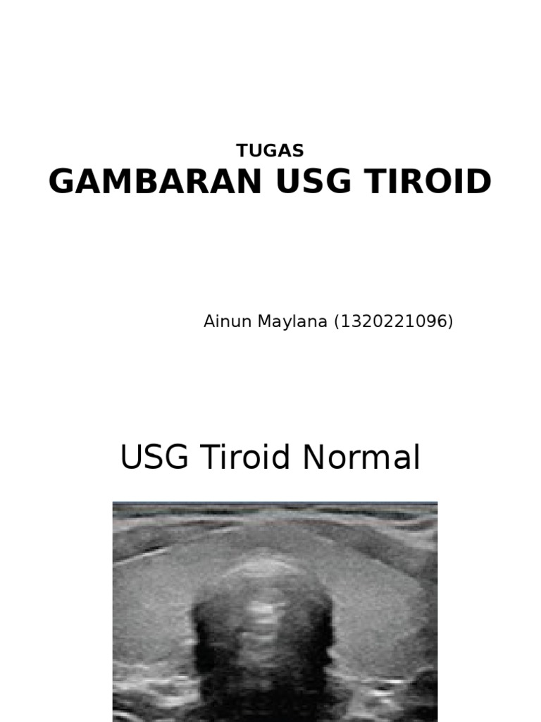 Usg Tiroid | PDF