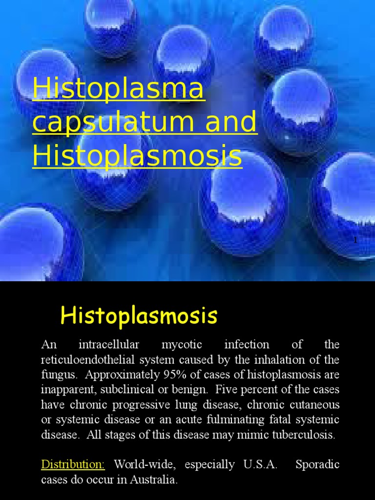 His To Plasm Osis | PDF | Medical Specialties | Clinical Medicine