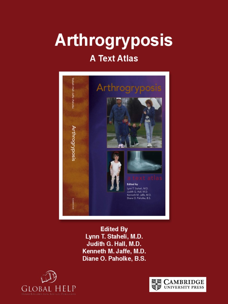 Arthrogryposis | PDF | Fetus | Congenital Disorder