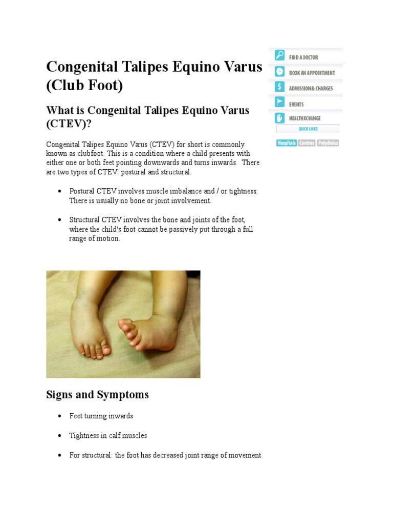 CTEV | Foot | Anatomical Terms Of Motion | Free 30-day Trial | Scribd