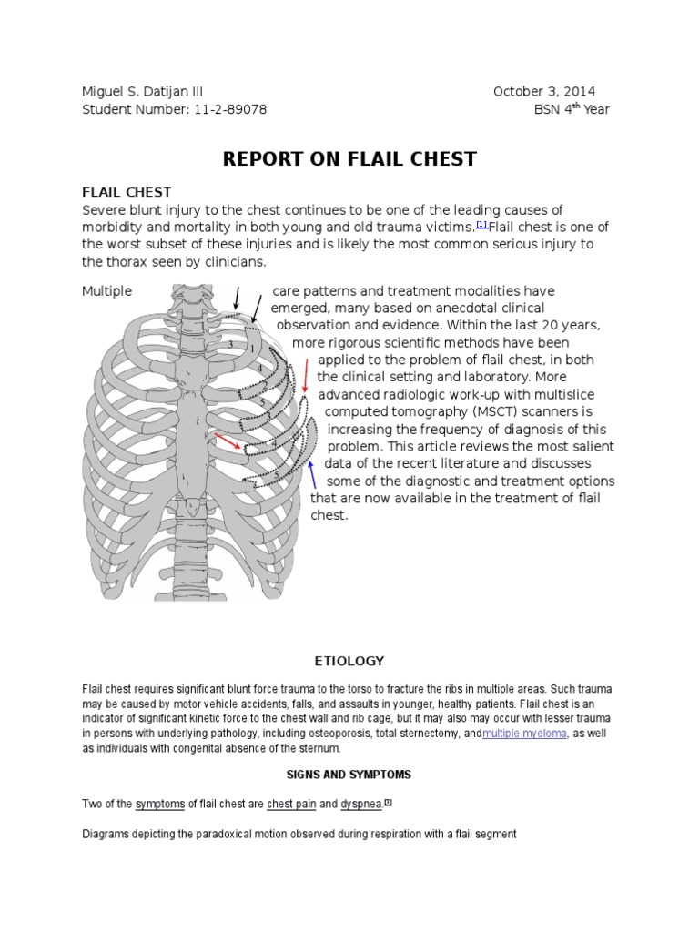 Flail Chest Report | PDF | Thorax | Pulmonology