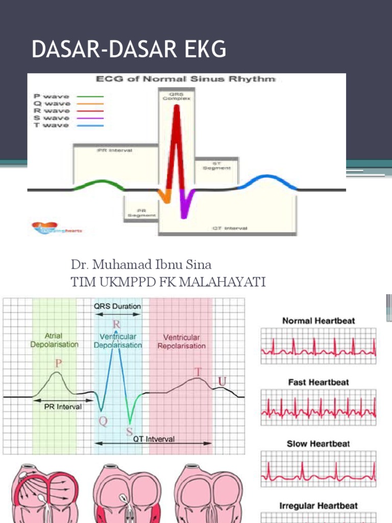 Ekg Dasar | PDF