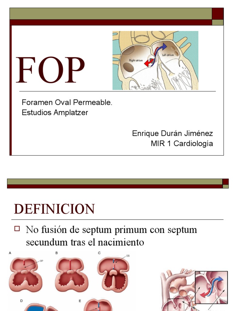 Fop | PDF | Embolia | Enfermedades vasculares